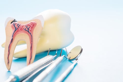 Apexification | Vital Pulp Therapy | Root Canal Treatment in Buffalo, NY